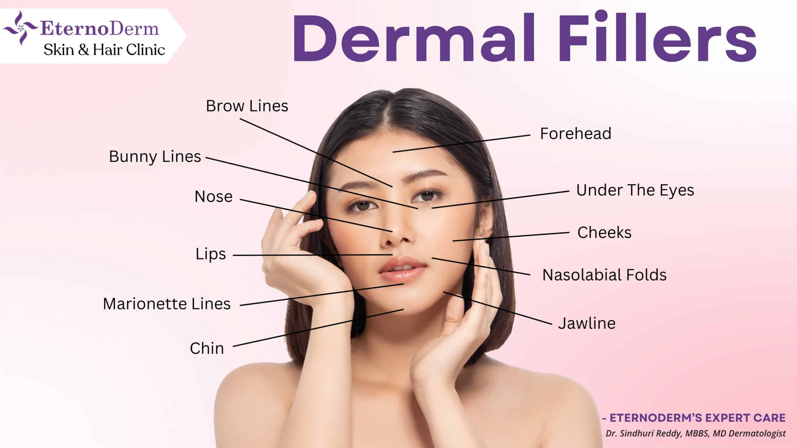 How Dermal Fillers Work: Expert Care at Eternoderm Clinic, Miyapur ...
